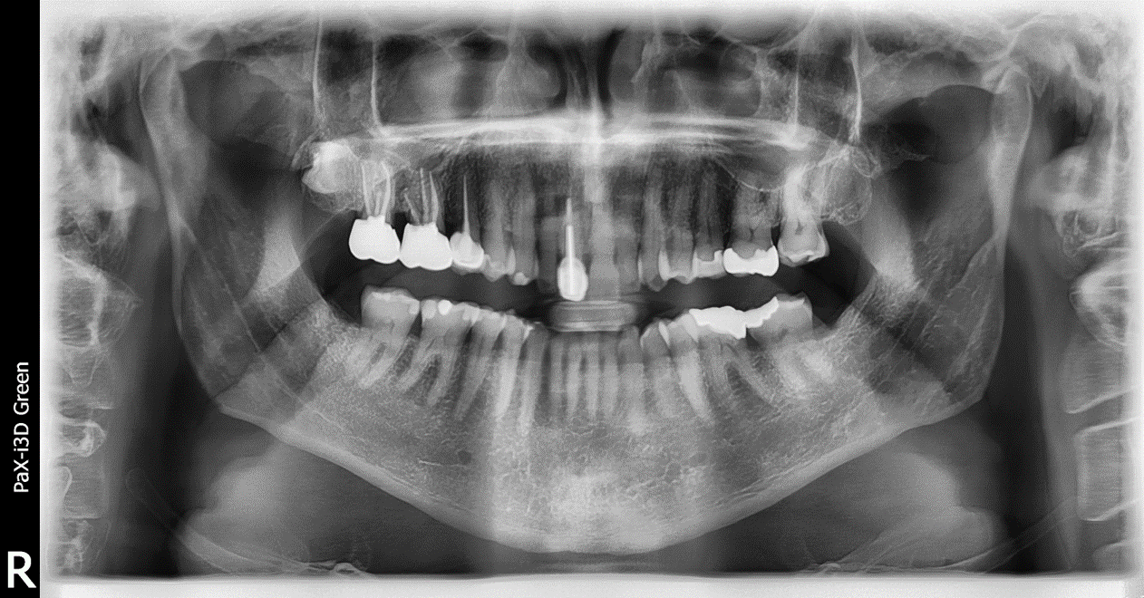 Sinus Pathology Imaging - GreenCT