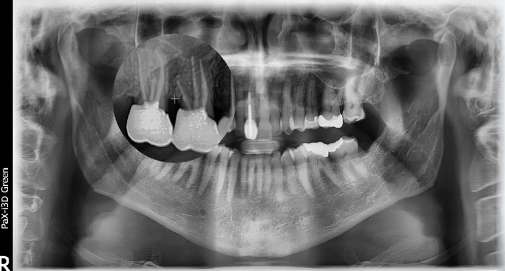 Sinus Pathology Imaging - GreenCT