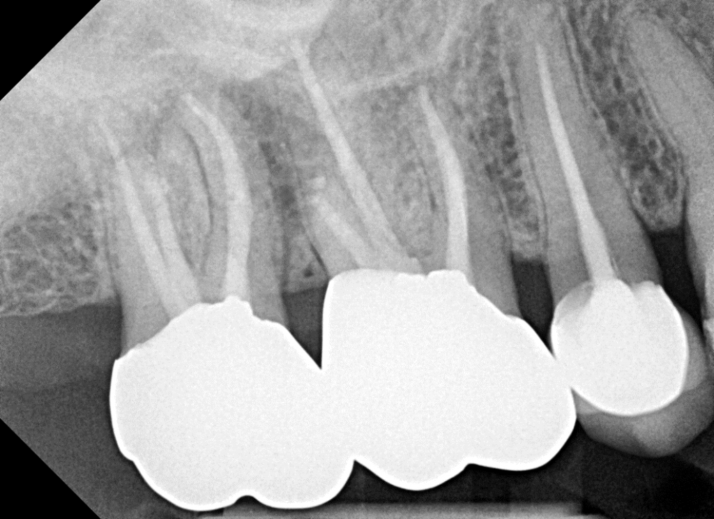 Sinus Pathology Imaging - GreenCT