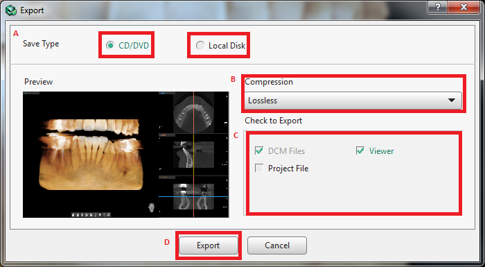 How to burn or Export 3D Dicom using Ez3Di to CD/DVD - GreenCT