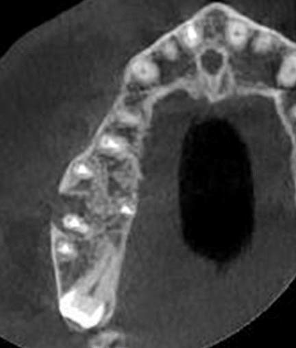 Sinus Pathology Imaging - GreenCT
